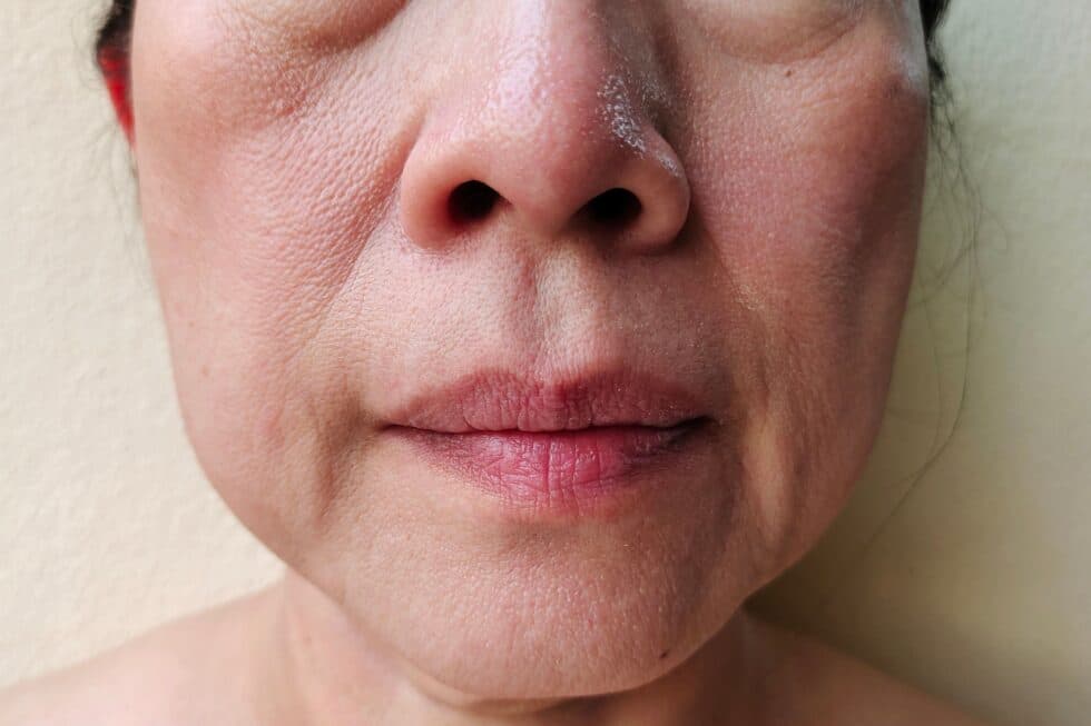 Sagging Skin Treatments - Freyja Medical