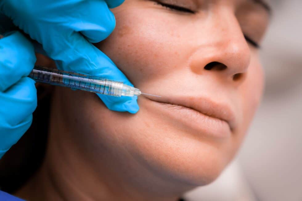 Dermal Filler Lumps: Identification & Management - Freyja Medical