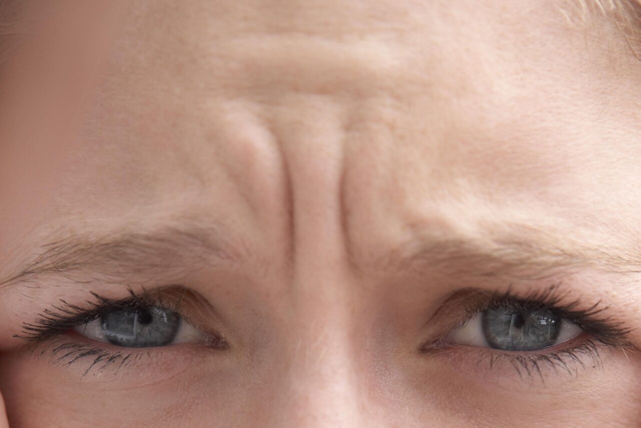 Static Wrinkles vs Dynamic Wrinkles: What's the Difference? - Freyja ...